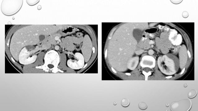 Ct abdomen protocols IMAGING guidelines.pptx