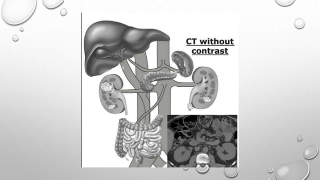 Ct abdomen protocols IMAGING guidelines.pptx