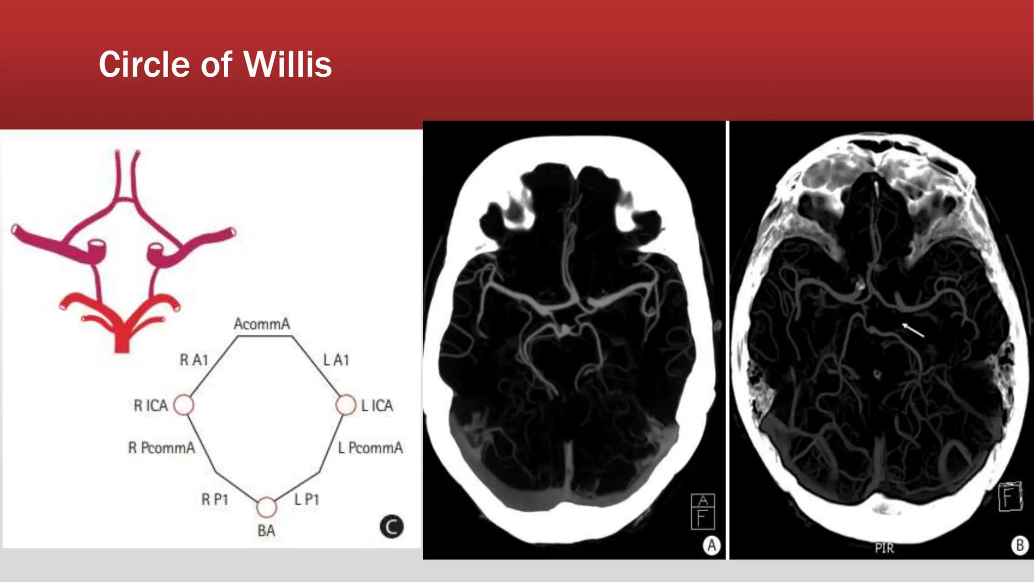 CTA Collateral Scoring system- RADIOLOGY 2 | PPTX