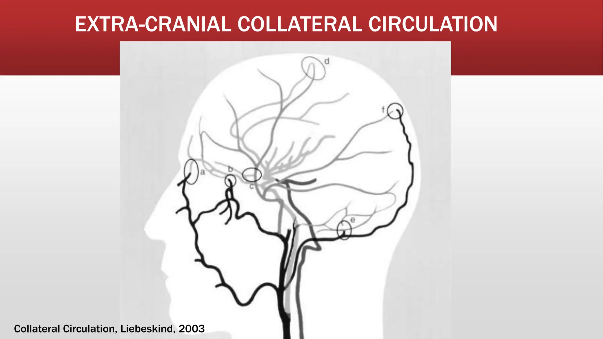 CTA Collateral Scoring system- RADIOLOGY 2 | PPTX