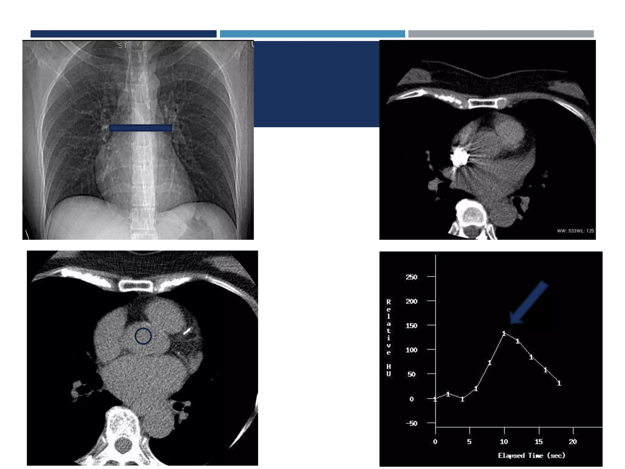 CT Angiography Head and Neck | PPTX