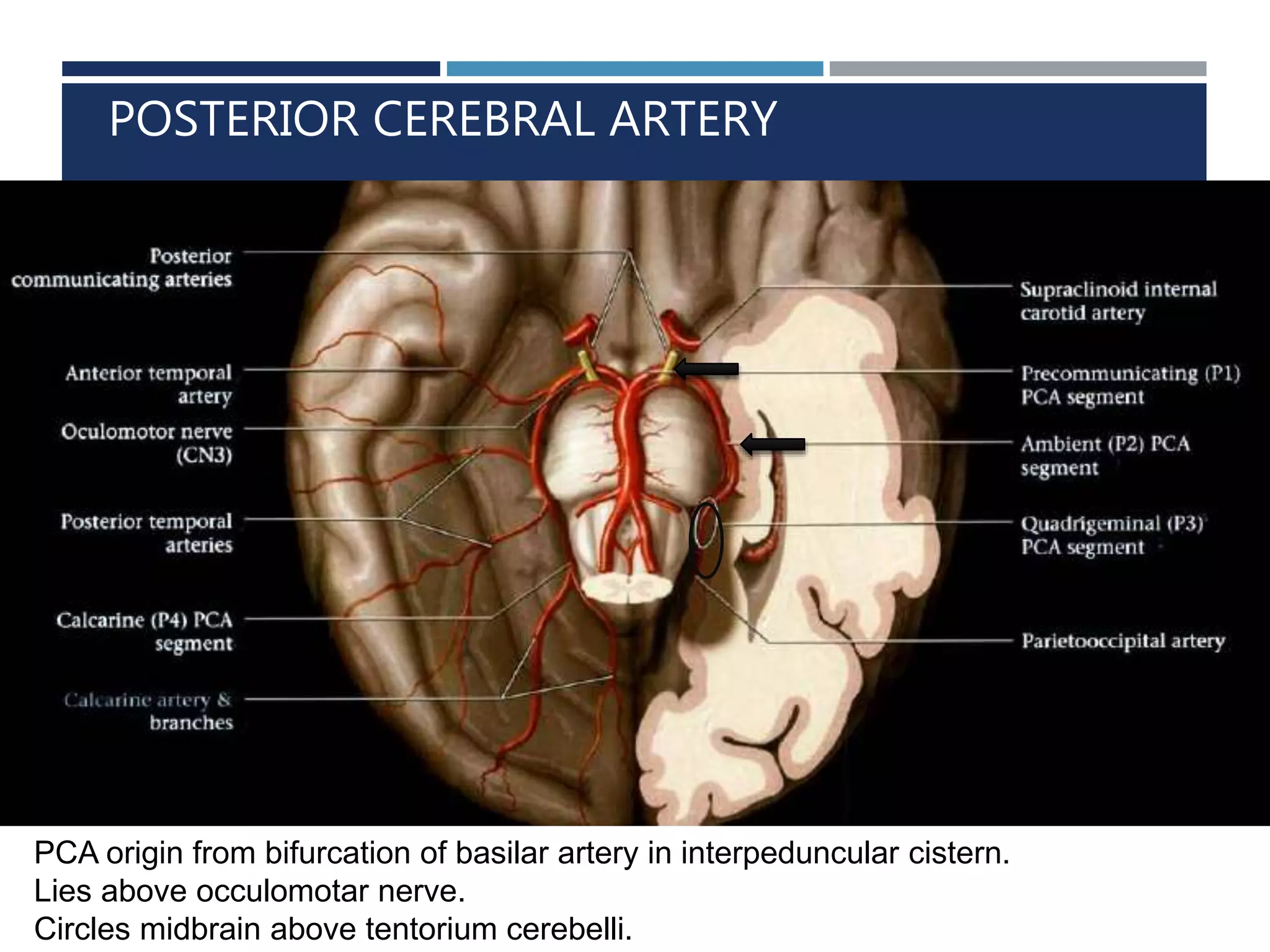 CT Angiography Head and Neck | PPTX