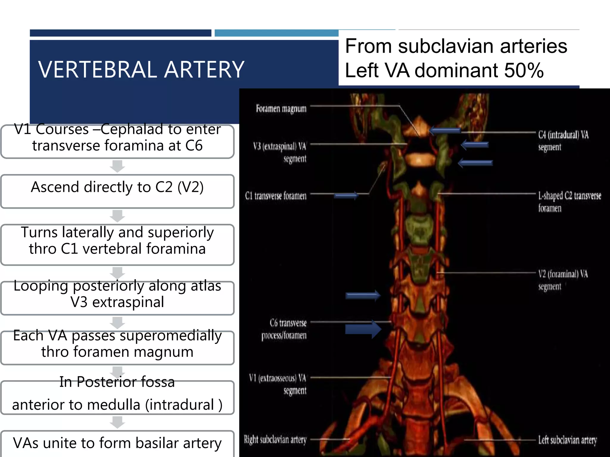 CT Angiography Head and Neck | PPTX