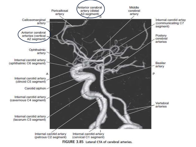 CT Angiography Head and Neck