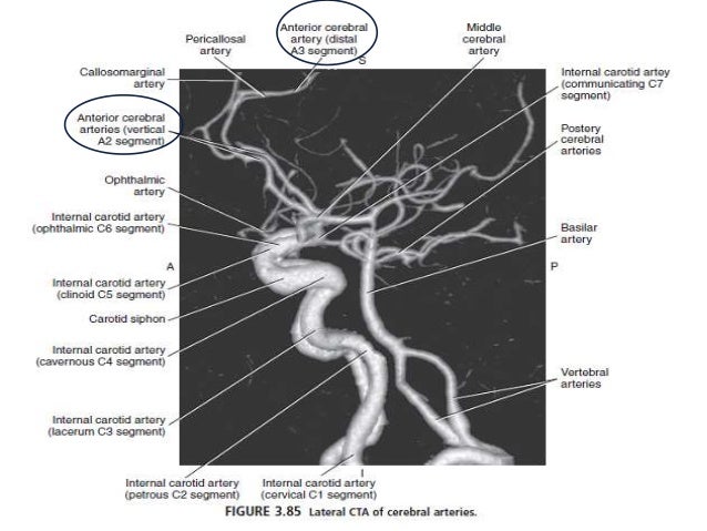 CT Angiography Head and Neck