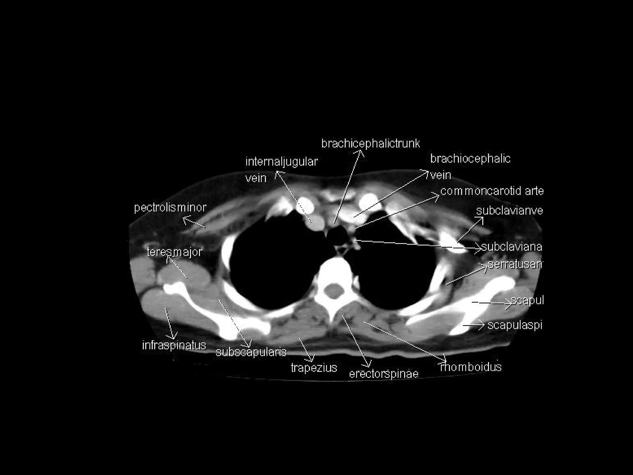 CT Anatomy | PPT