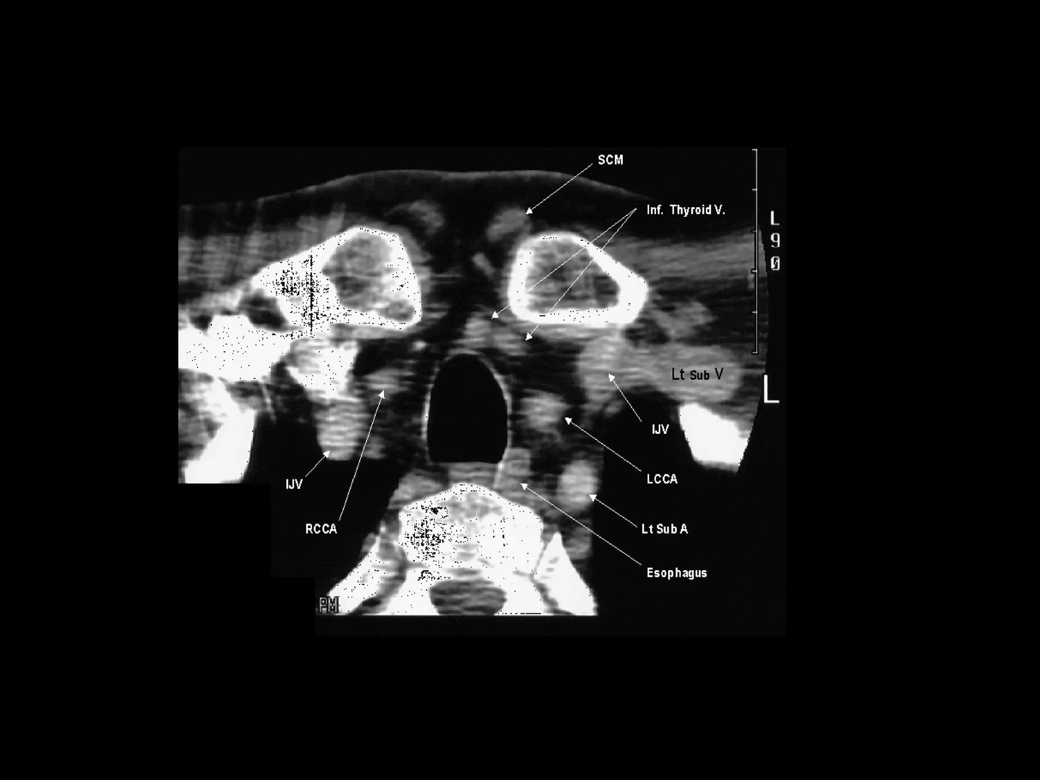 CT Anatomy | PPT