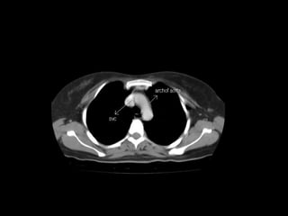 CT Anatomy | PPT