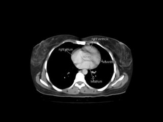 CT Anatomy | PPT