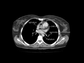 CT Anatomy | PPT