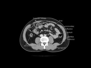 CT Anatomy | PPT