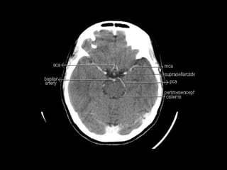 CT Anatomy | PPT