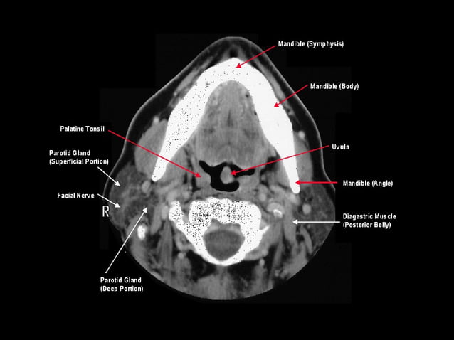 CT Anatomy