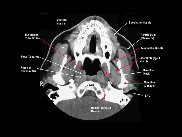 CT Anatomy