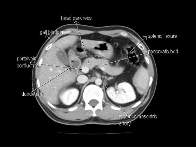 CT Anatomy