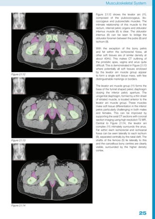 CT Anatomy for Radiotherapy.pdf eryuioooop | PDF