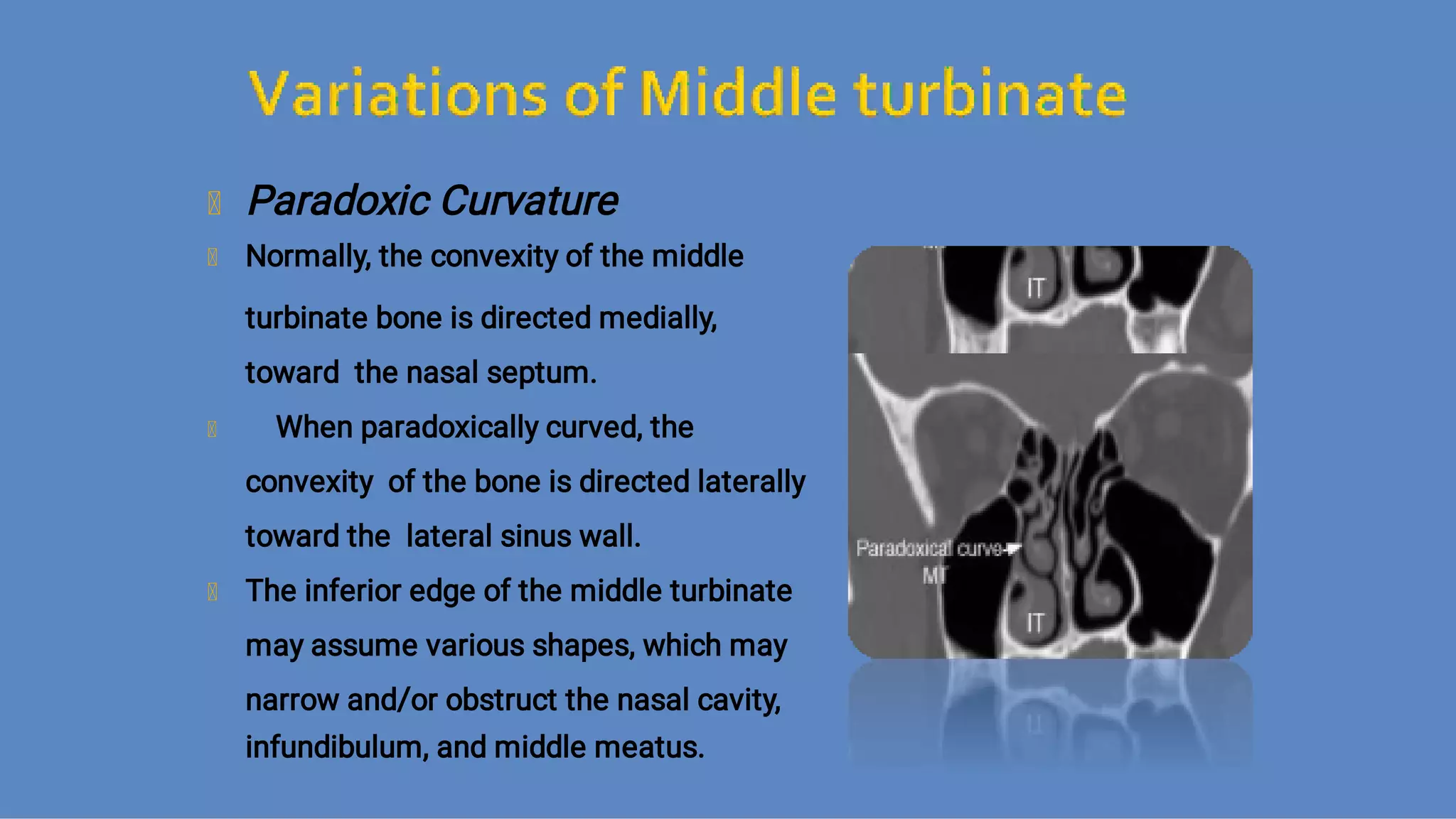 Ct anatomy of paranasal sinuses( PNS) pk.pdf ppt | PDF