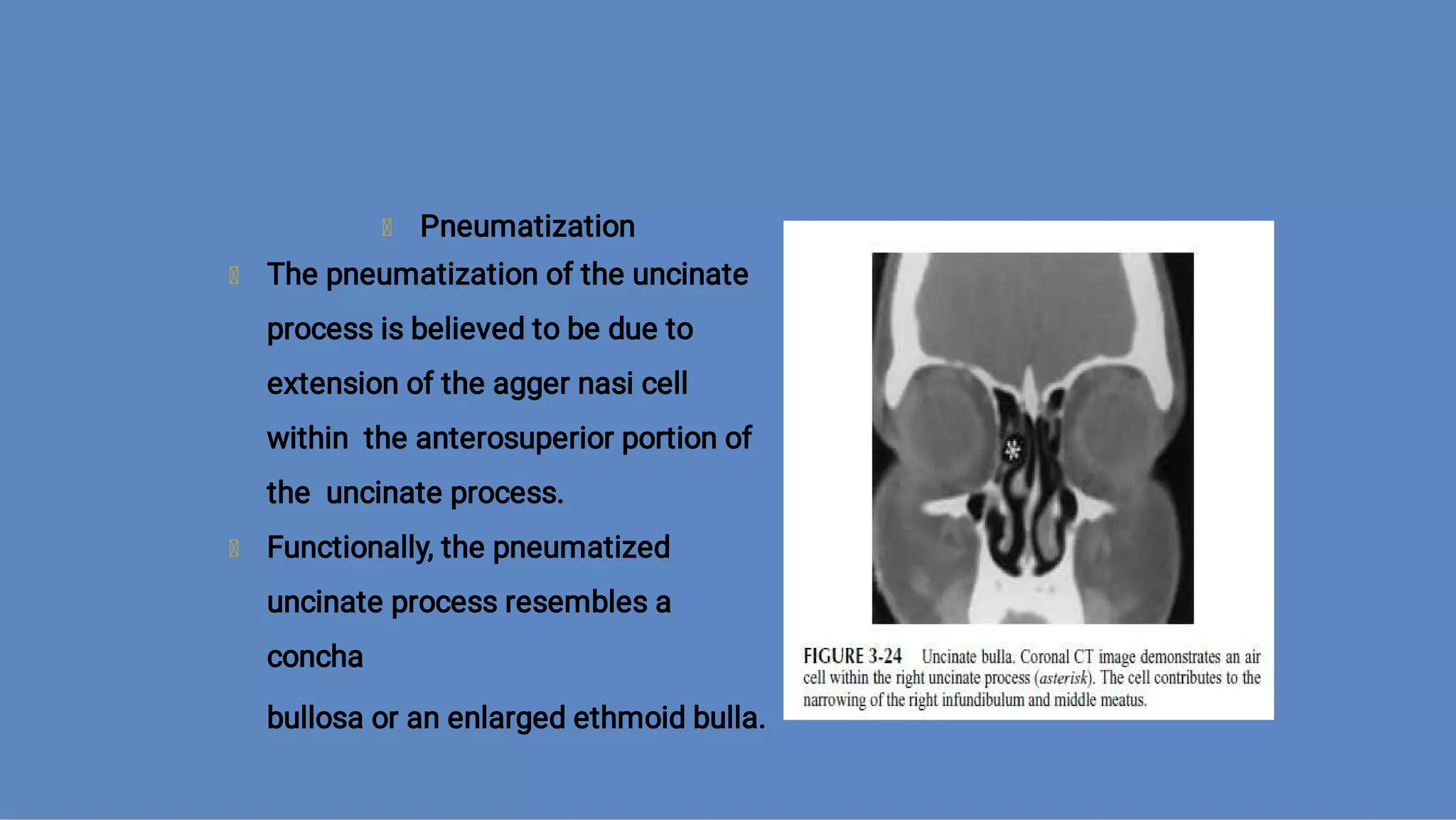 Ct anatomy of paranasal sinuses( PNS) pk.pdf ppt | PDF