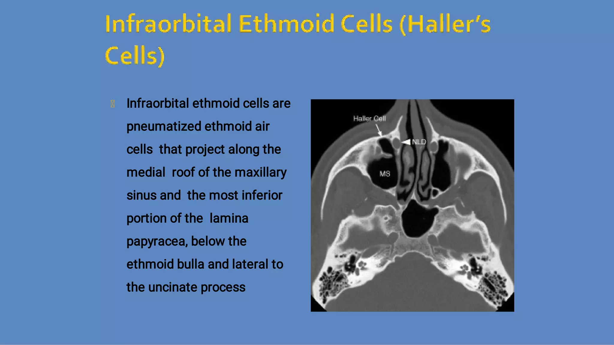 Ct anatomy of paranasal sinuses( PNS) pk.pdf ppt | PDF
