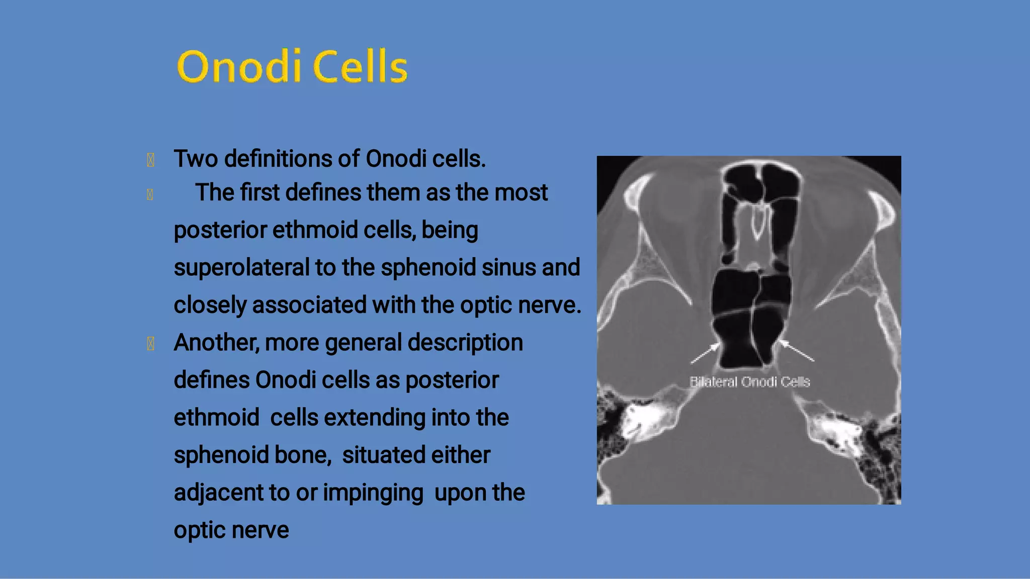 Ct anatomy of paranasal sinuses( PNS) pk.pdf ppt | PDF