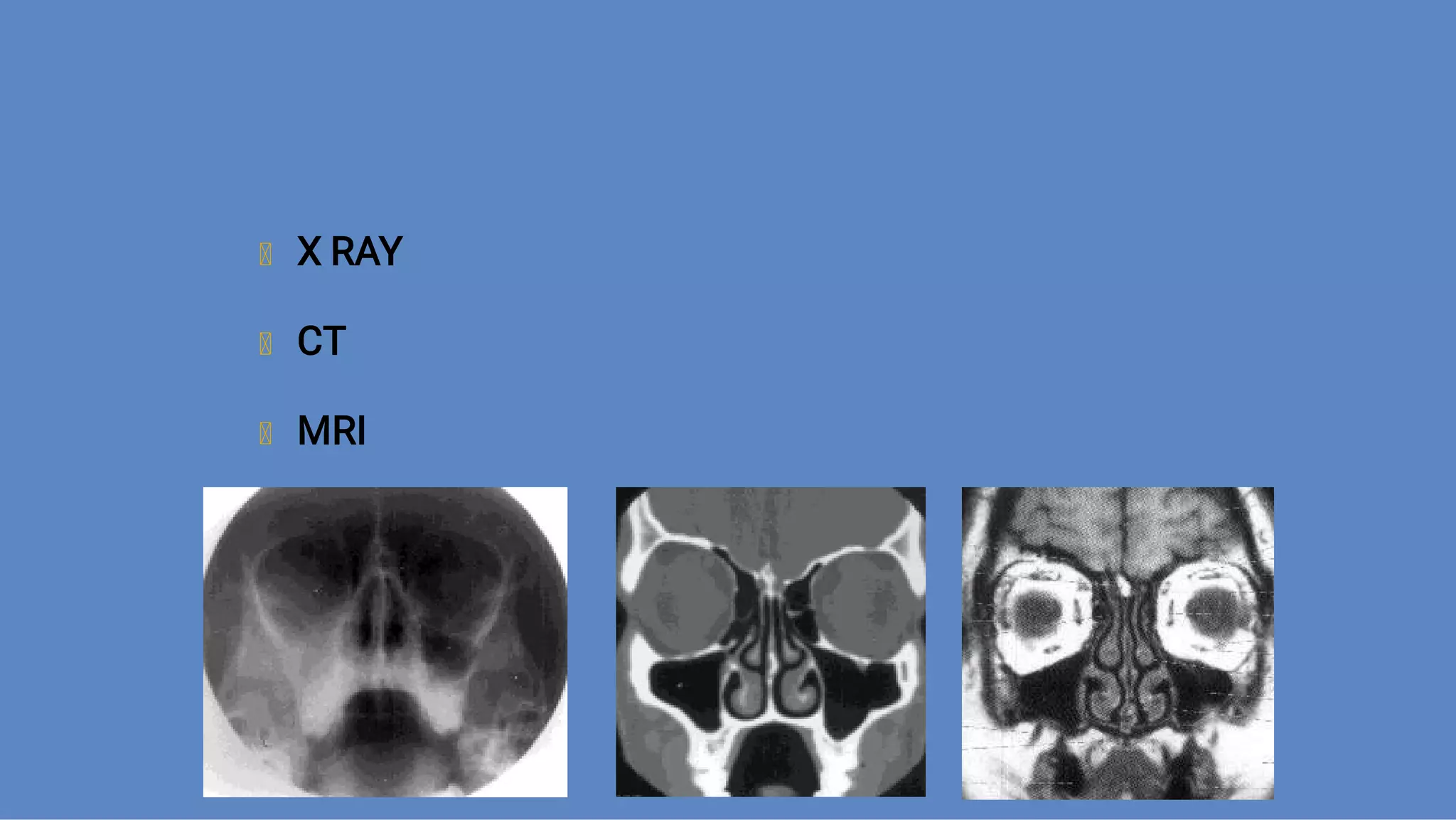 Ct anatomy of paranasal sinuses( PNS) pk.pdf ppt | PDF
