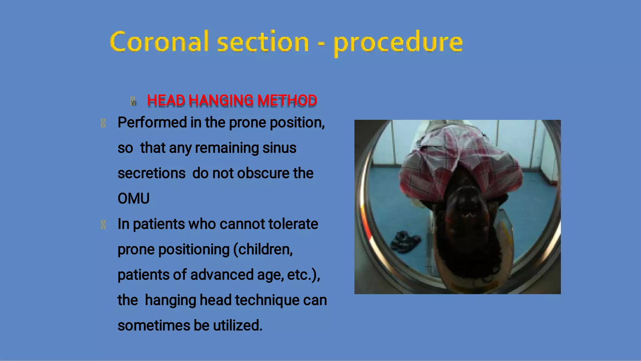 Ct anatomy of paranasal sinuses( PNS) pk.pdf ppt | PDF