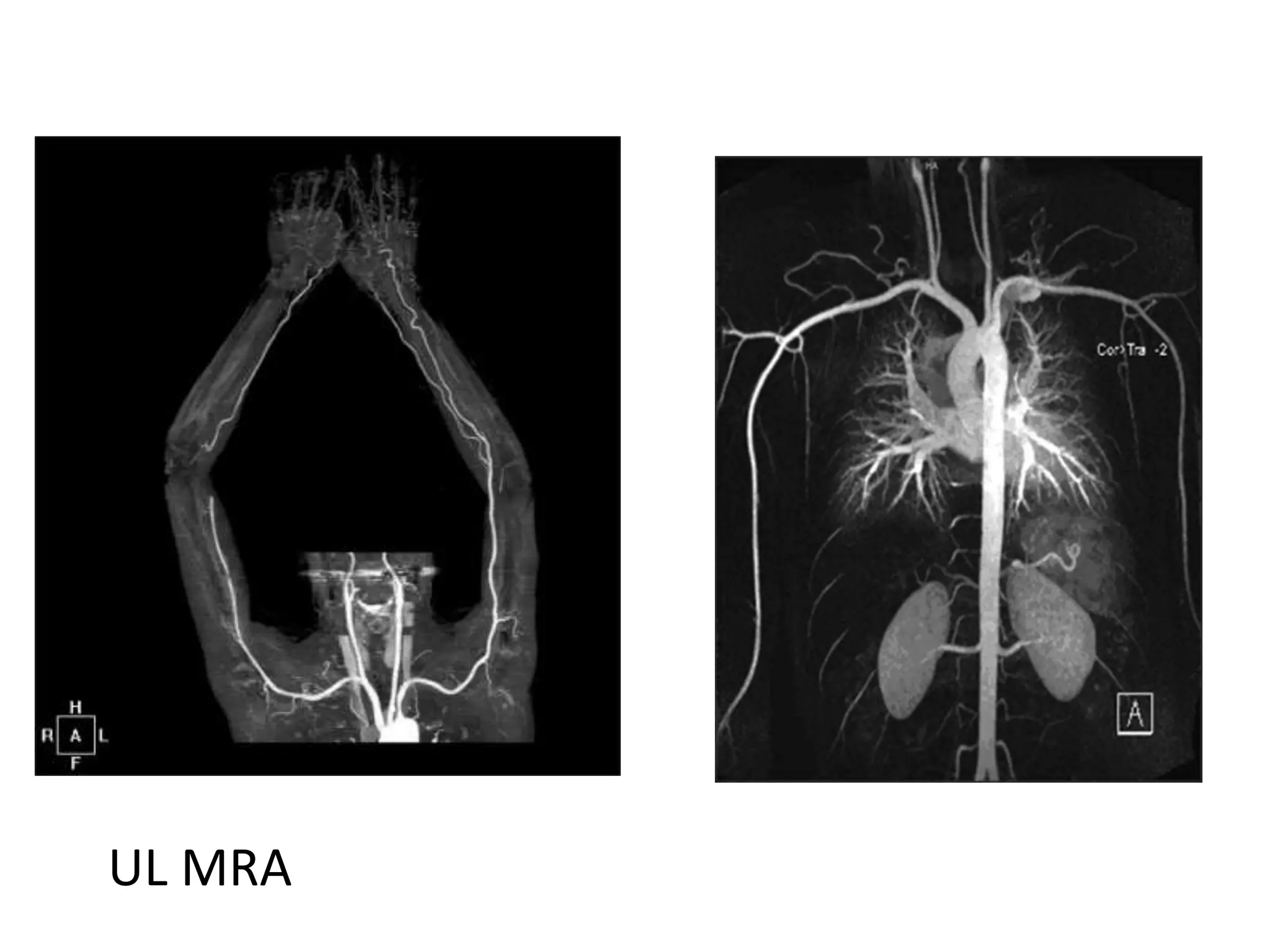 Ct and mr angiography | PPTX | Death, Injury, or Military Conflict ...