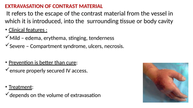 ct and mri contrast agents presentations | PPT