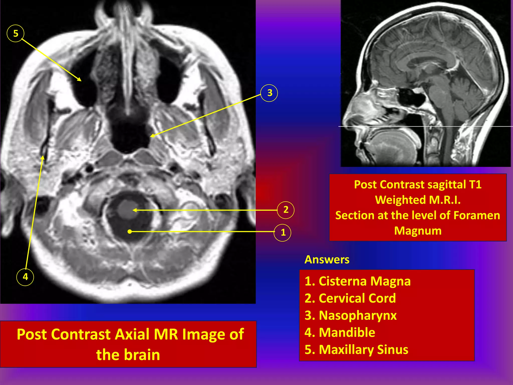 Ct and mri interpretation | PPTX
