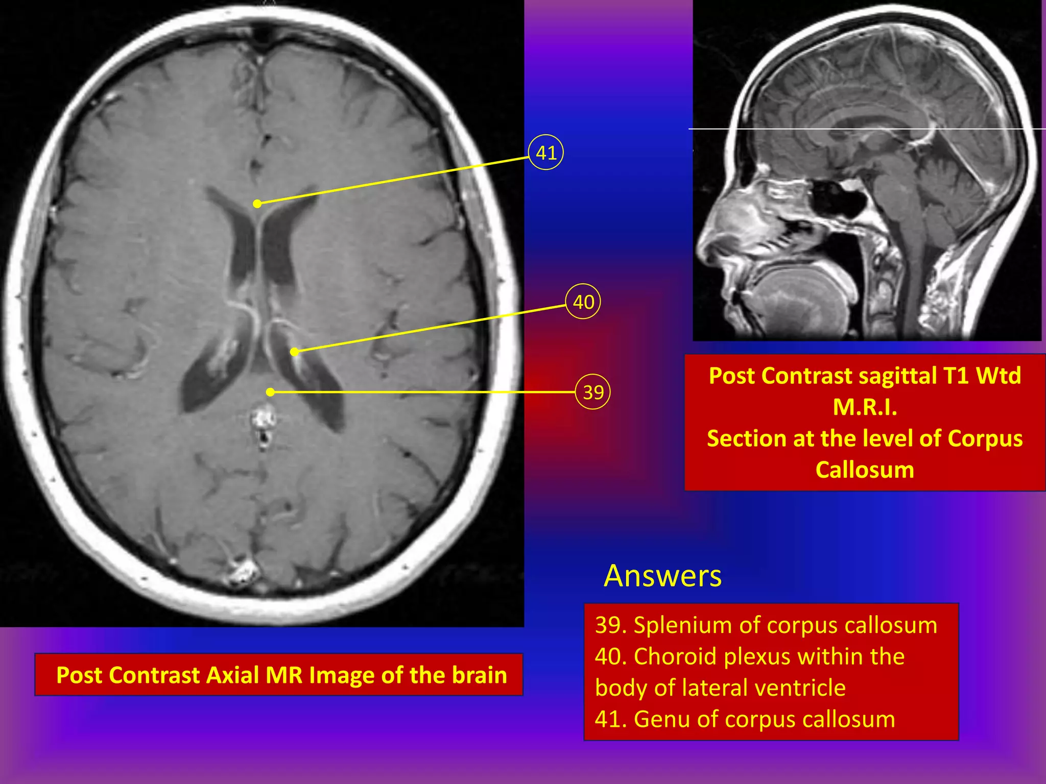 Ct and mri interpretation | PPTX