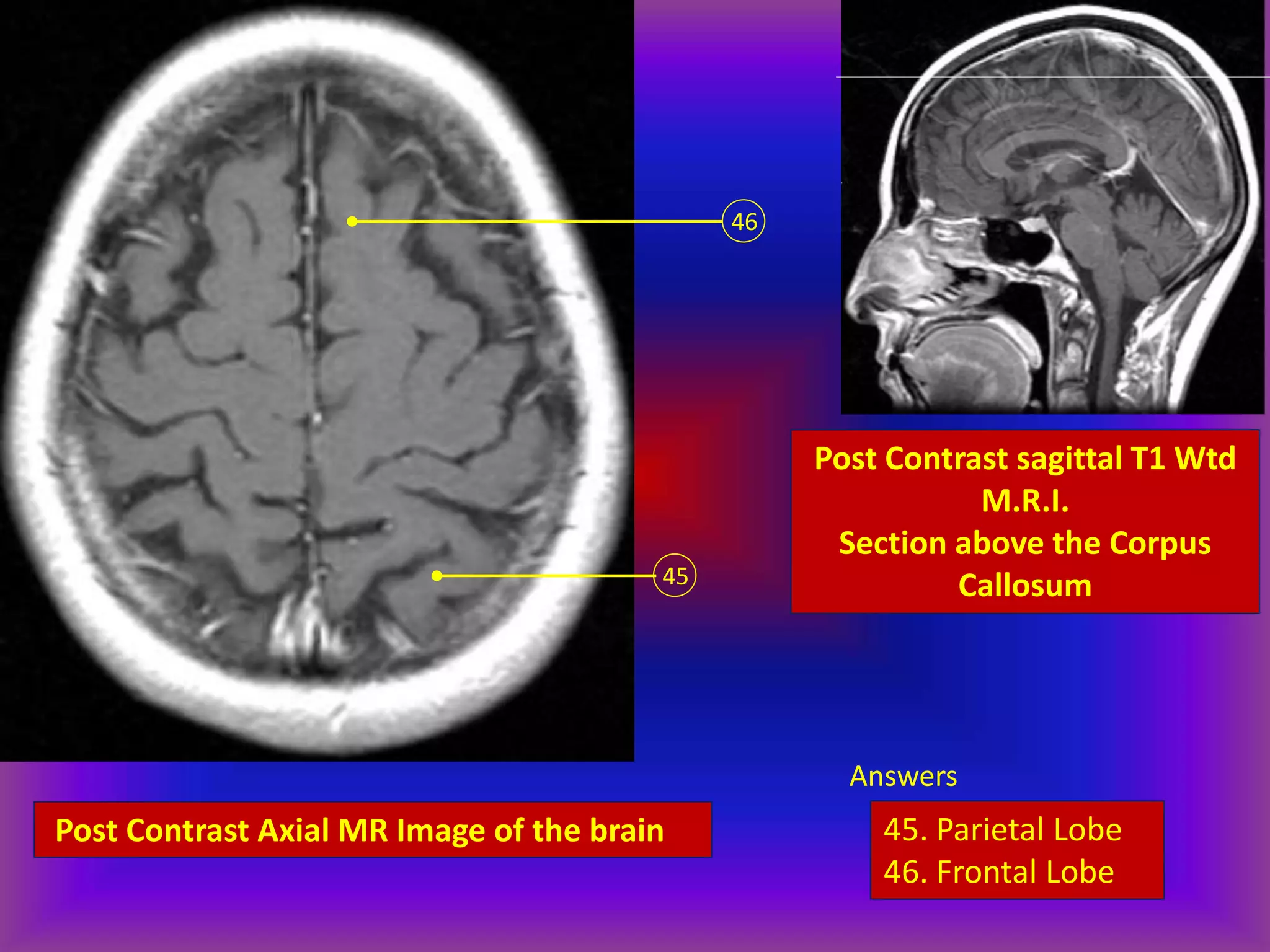 Ct and mri interpretation | PPTX
