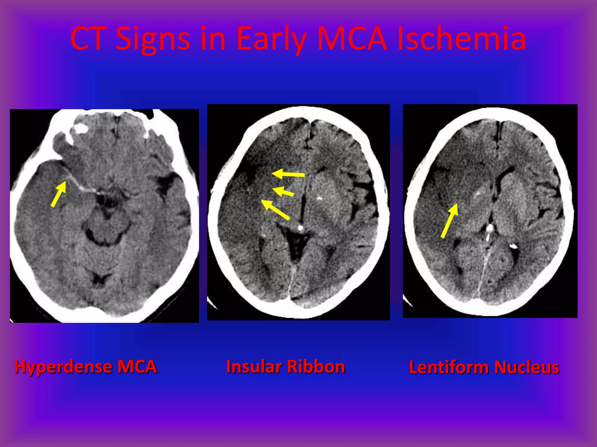 Ct and mri interpretation | PPTX