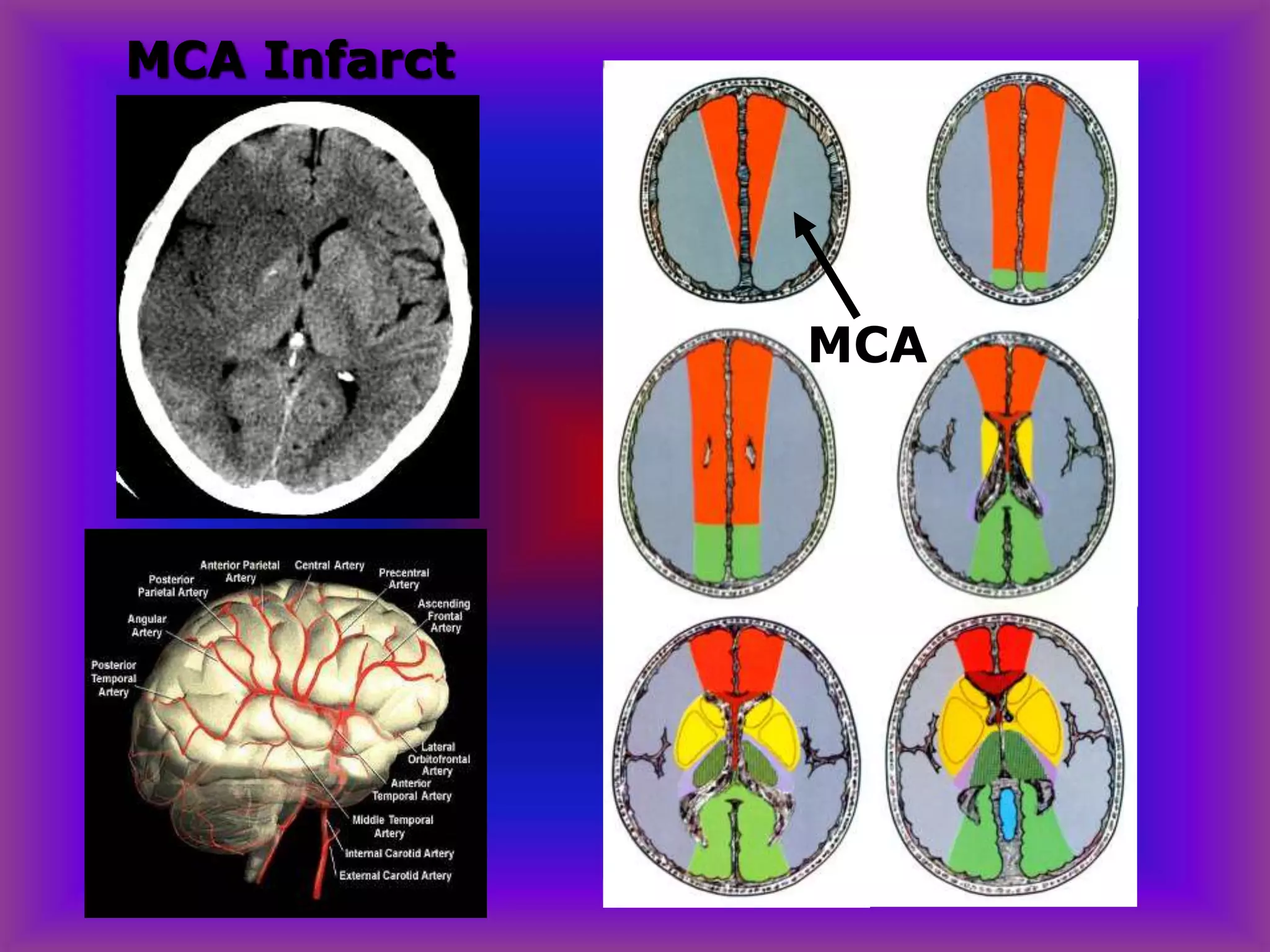 Ct and mri interpretation | PPTX