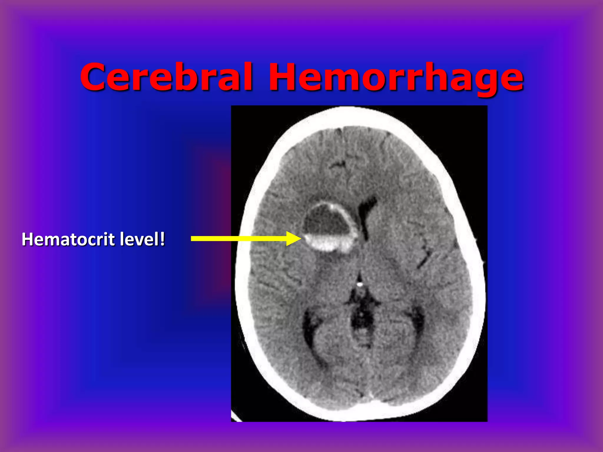 Ct and mri interpretation | PPTX