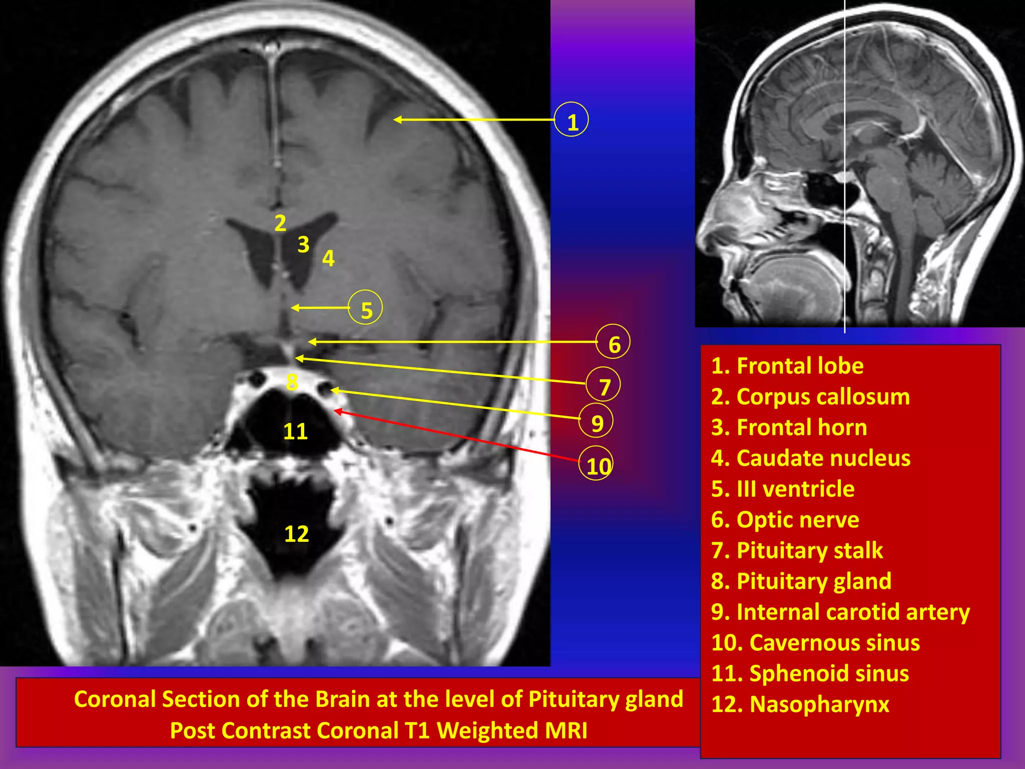 Ct and mri interpretation | PPTX