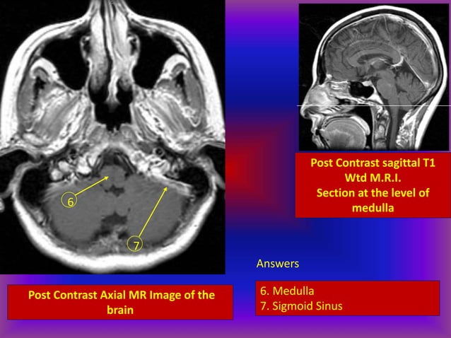 Ct and mri interpretation | PPTX