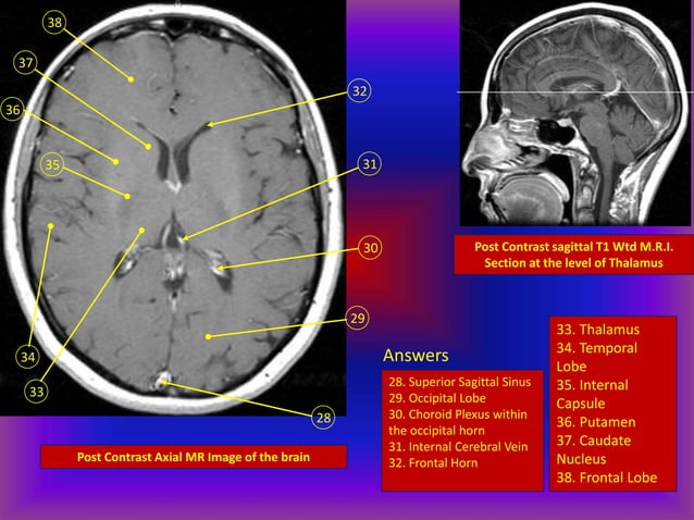 Ct and mri interpretation | PPTX