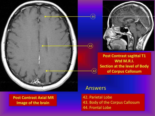 Ct and mri interpretation | PPTX