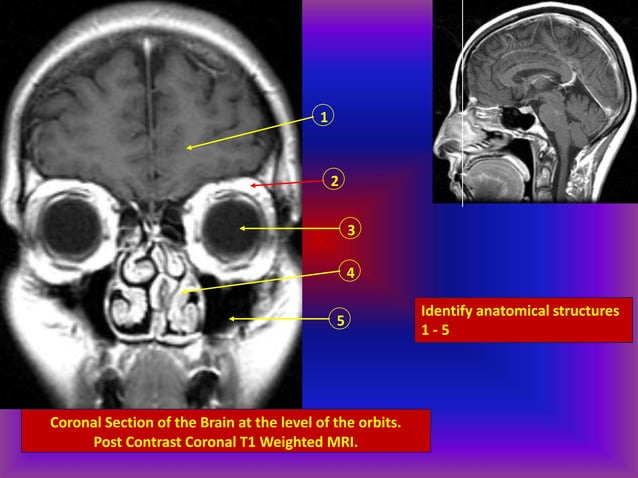 Ct and mri interpretation | PPTX