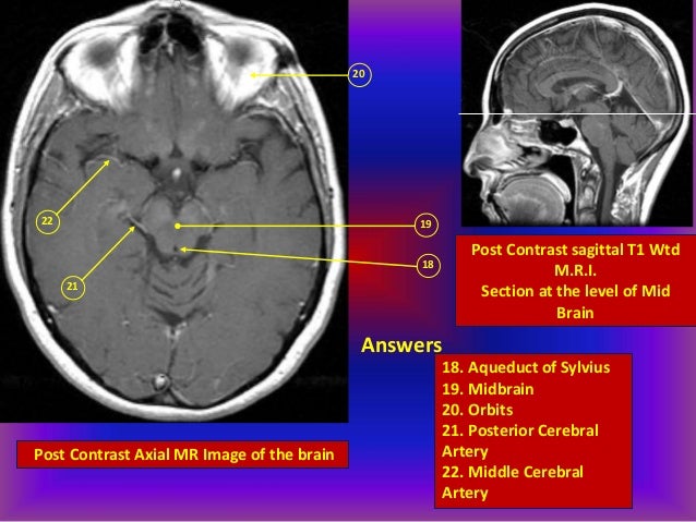 Ct and mri interpretation