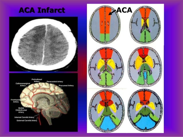 Ct and mri interpretation
