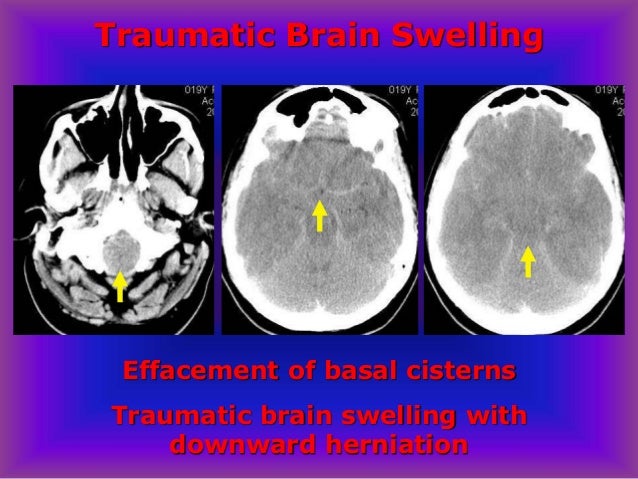 Ct and mri interpretation