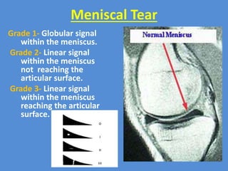 Ct and mri,ppt | PPTX