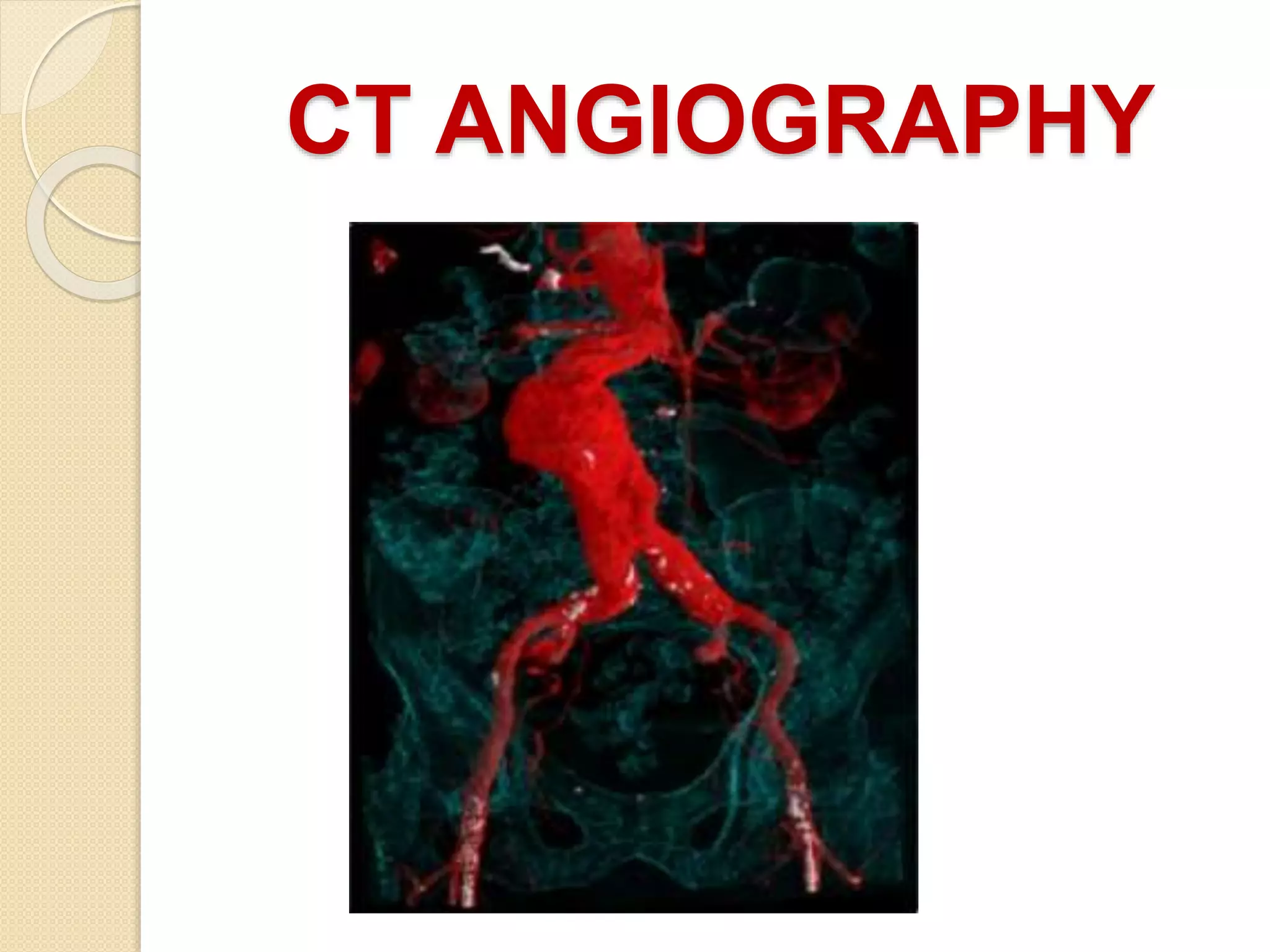 CT angiography | PPTX