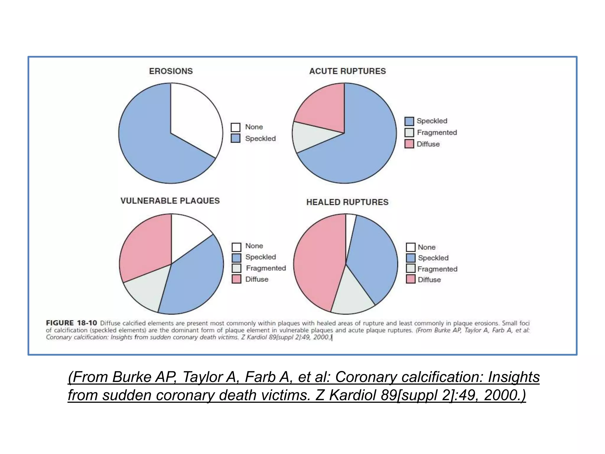 Ct angio in cardiology | PPTX