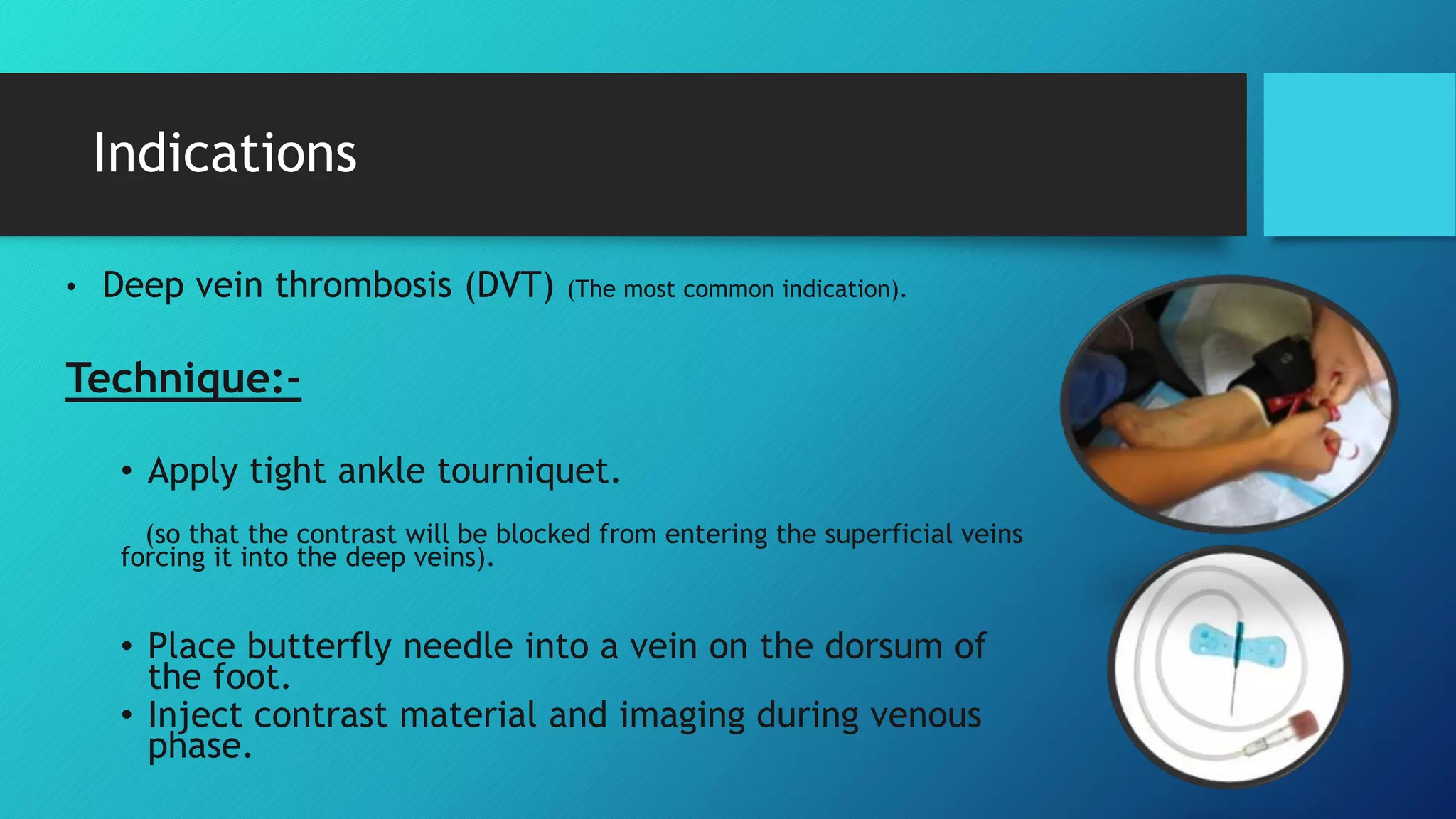 CT Angiography.pptx