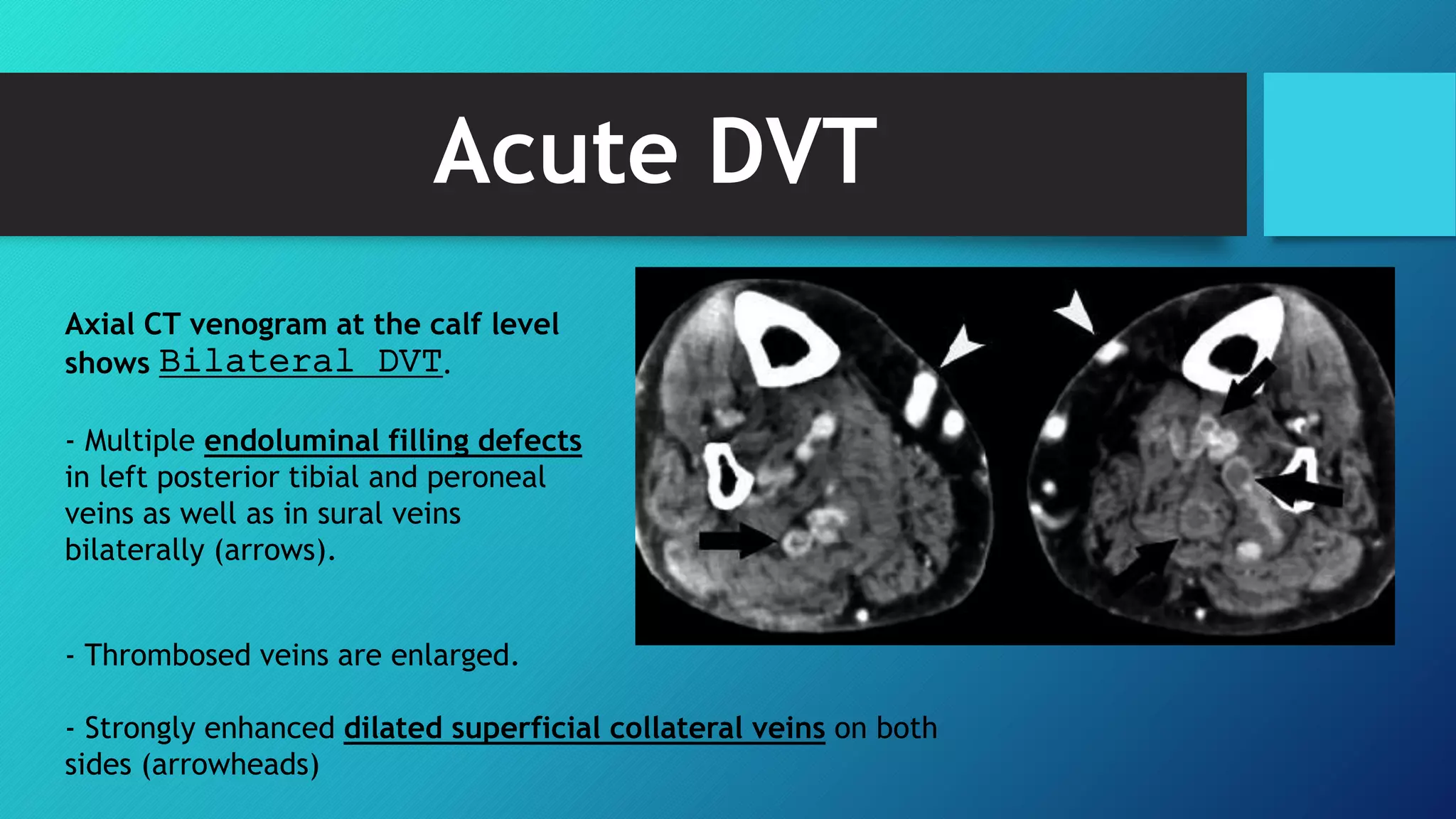 CT Angiography.pptx