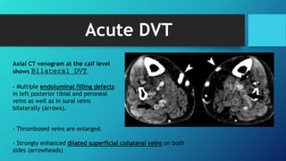 CT Angiography.pptx