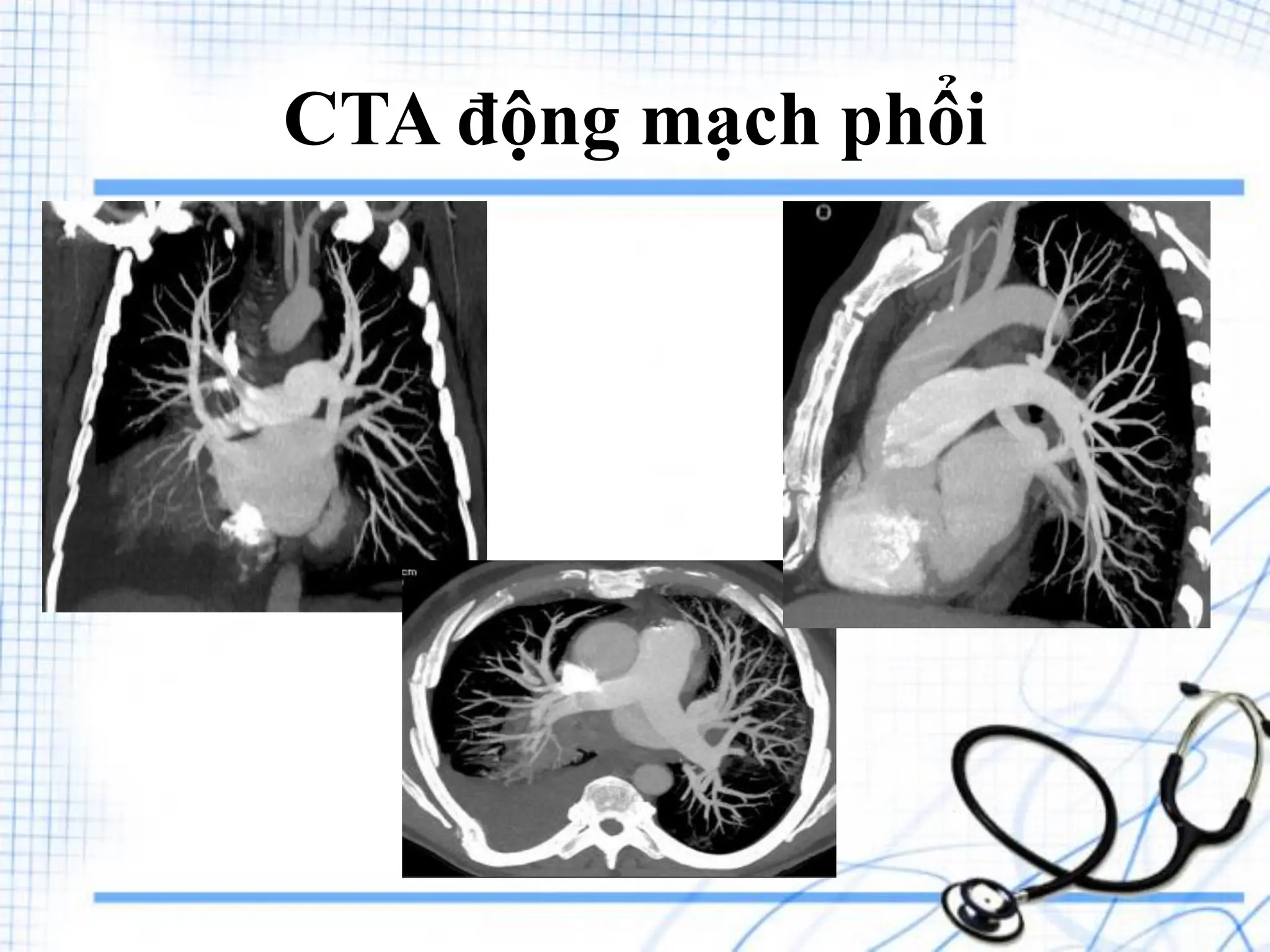 CT Angiography.pdf