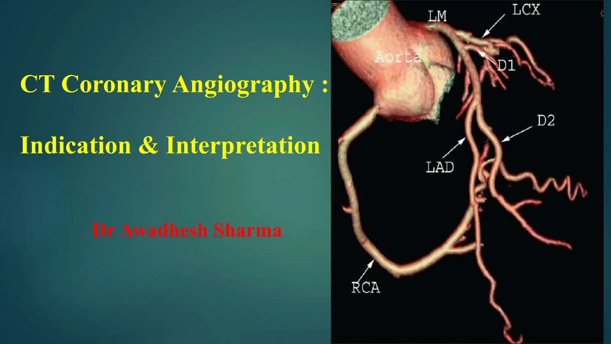 CT angiography.pptx